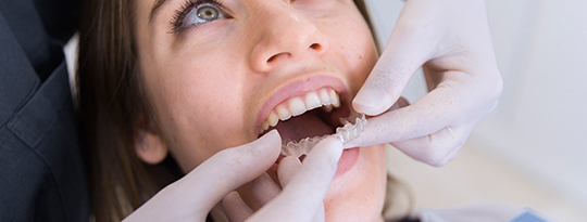 Bite Adjustment - Advanced Periodontics